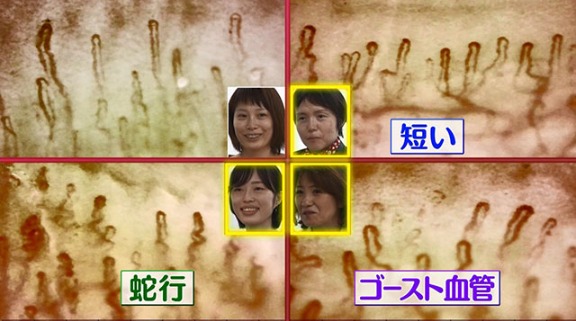 NHK BS プレミアム『美と若さの新常識～カラダのヒミツ～』に毛細血管・研究会が企画協力いたしました - NPO法人毛細血管・研究会